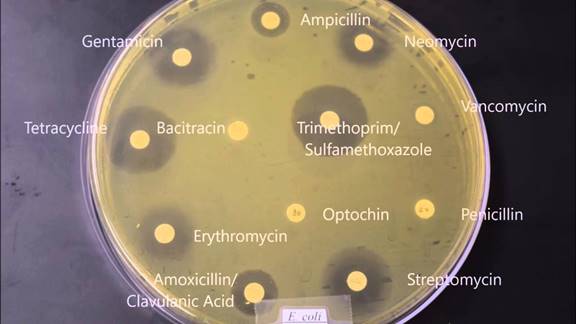 Chapter 5: Control of Microbial Growth